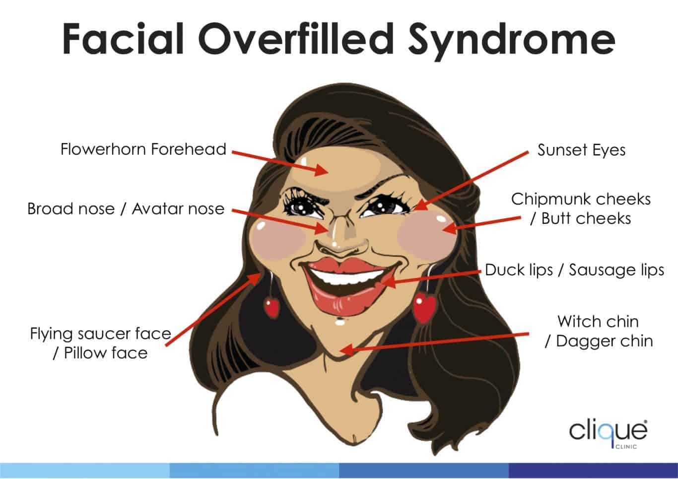 How To Avoid Facial Overfilled Syndrome With Fillers? 4 Things You ...