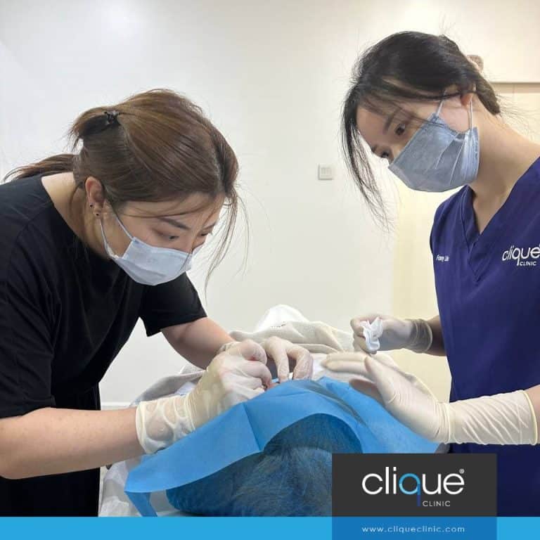 Face Thread Lift: Procedure, Benefits And More | Clique Clinic