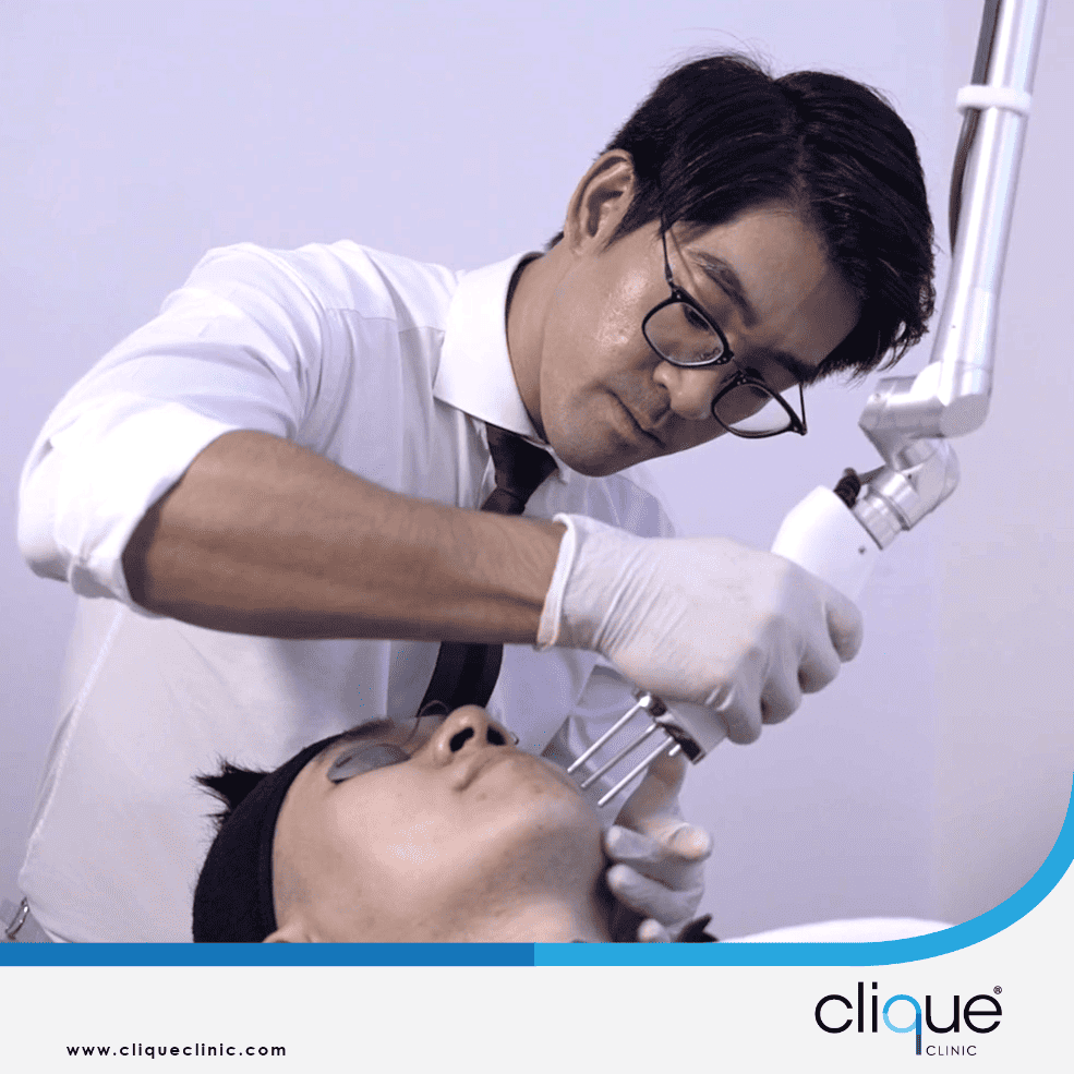 Lip Laser Treatment (Pico Laser) | Clique Clinic